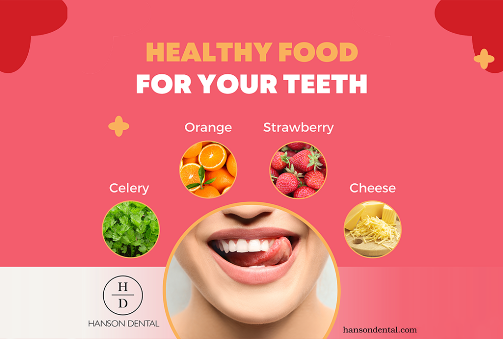 Healthy Foods for Your Teeth - Hanson Dental - Dentist in Buffalo MN